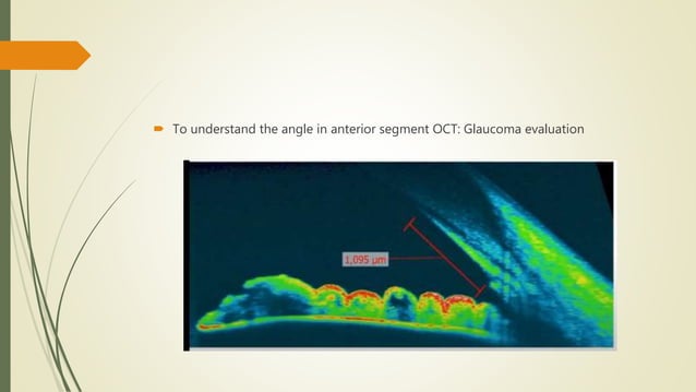 Anatomy of limbus, Stem cell deficiency.pptx