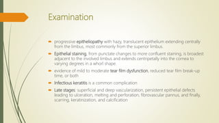 Anatomy of limbus, Stem cell deficiency.pptx
