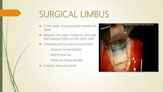 Anatomy of limbus, Stem cell deficiency.pptx