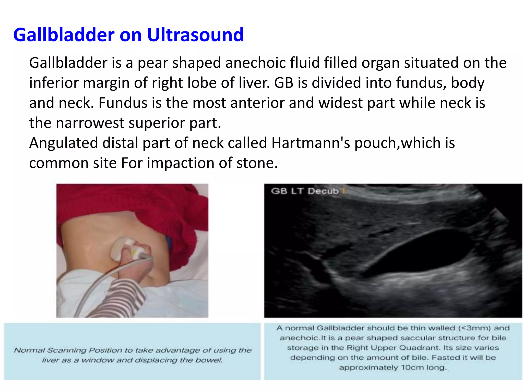 Anatomy of liver, spleen , pancreas(radiological) | PPTX