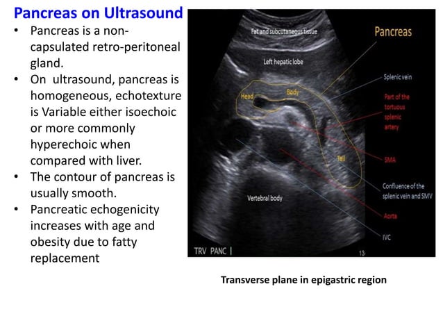 Anatomy of liver, spleen , pancreas(radiological) | PPTX | Medical Health