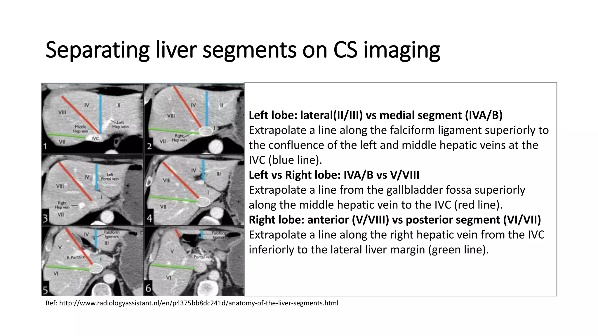 Anatomy of liver | PPTX