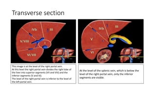 Transpyloric Plane Cross Section