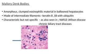 ANATOMY OF LIVER hepatology physiology and | PPTX