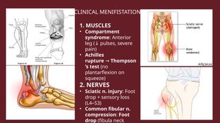 Regional anatomy lower limb. It has everything you need to study lower ...