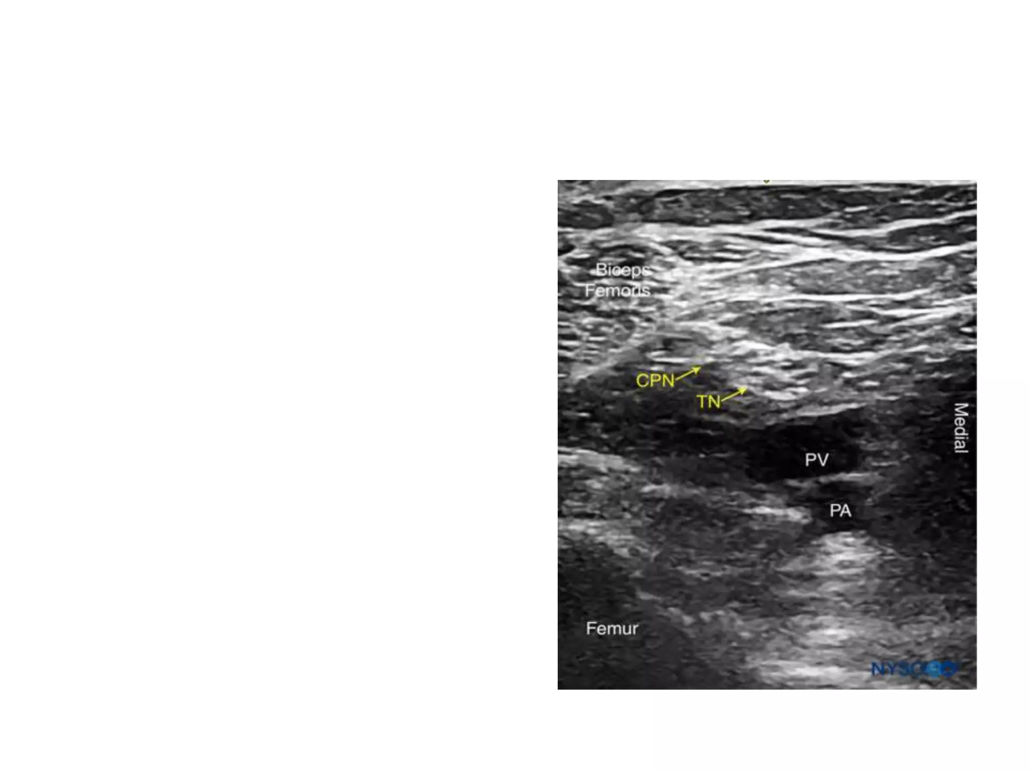 ANATOMY OF LOWER LIMB BLOCKS.pptx
