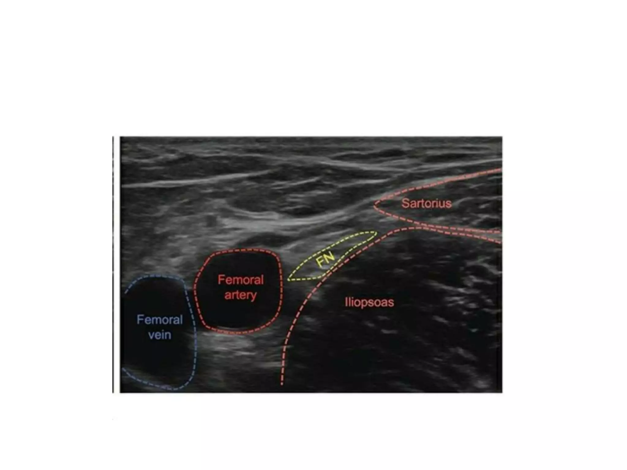 ANATOMY OF LOWER LIMB BLOCKS.pptx