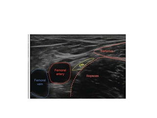 ANATOMY OF LOWER LIMB BLOCKS.pptx
