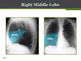 Anatomy of lung & pleura | PPT
