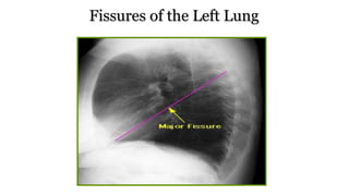 Anatomy of lungs, pleura and diaphragm | PPTX