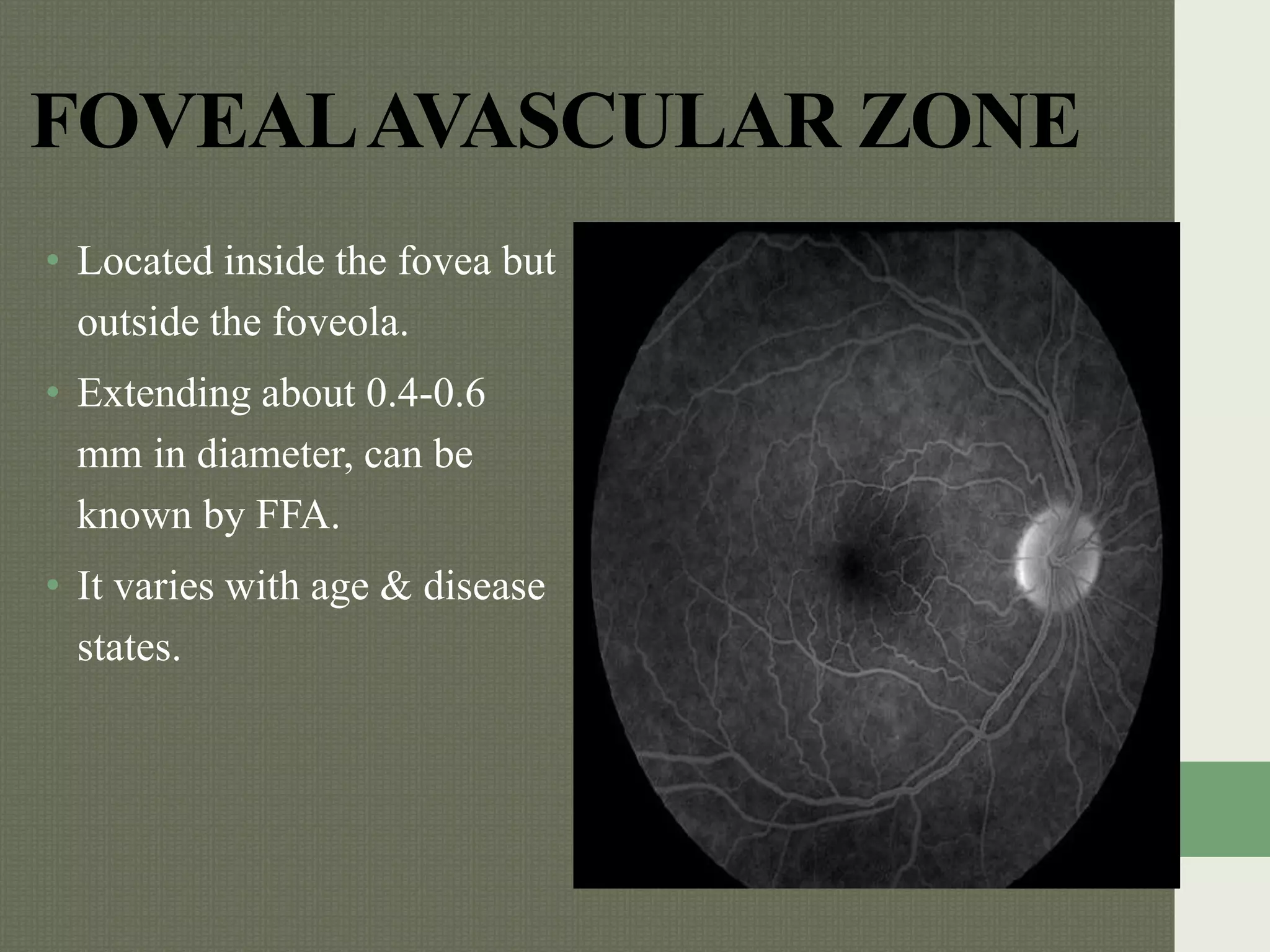 Anatomy of macula | PPTX | Eye and Vision Conditions | Diseases and ...