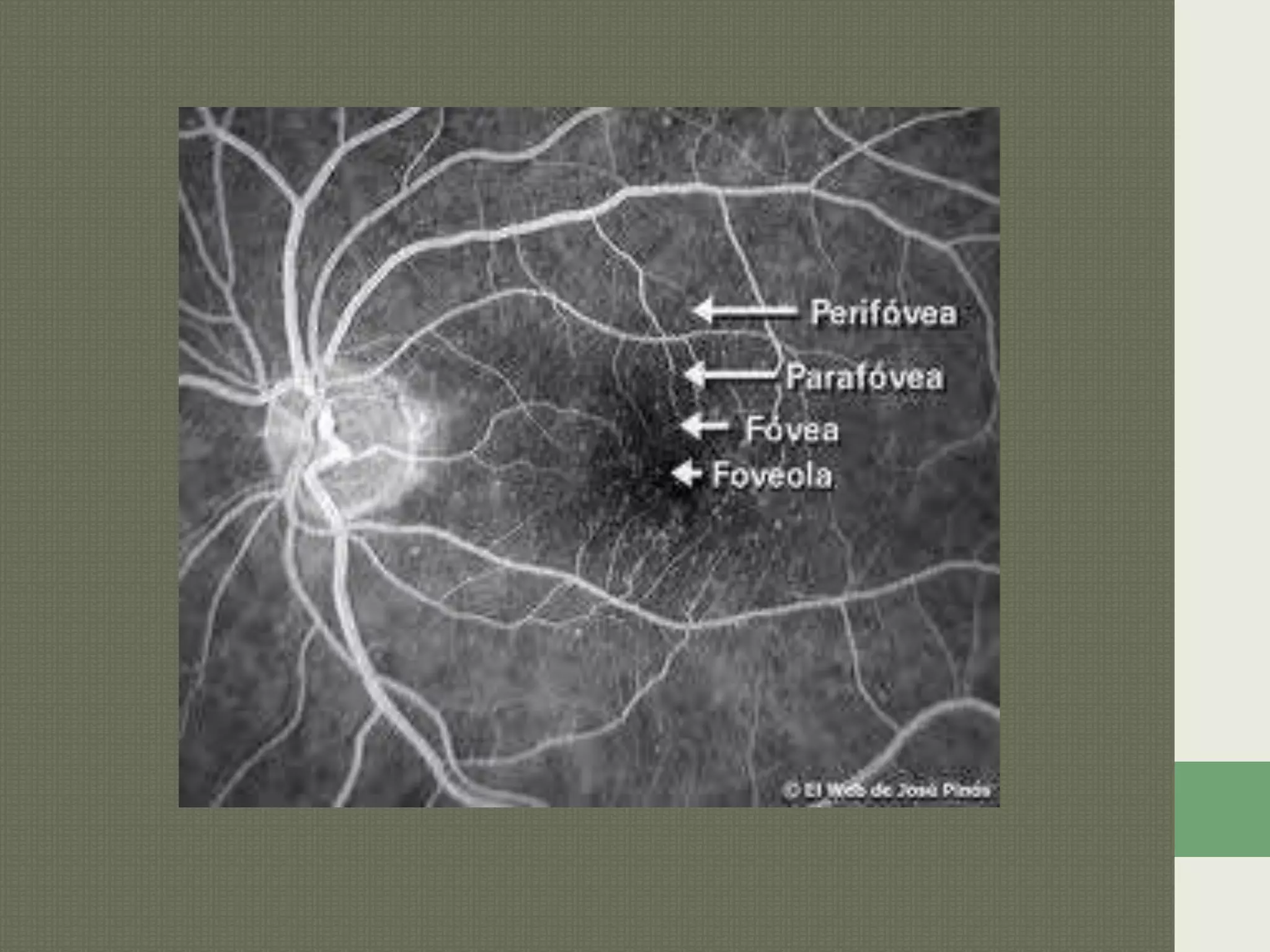 Anatomy of macula | PPTX | Eye and Vision Conditions | Diseases and ...