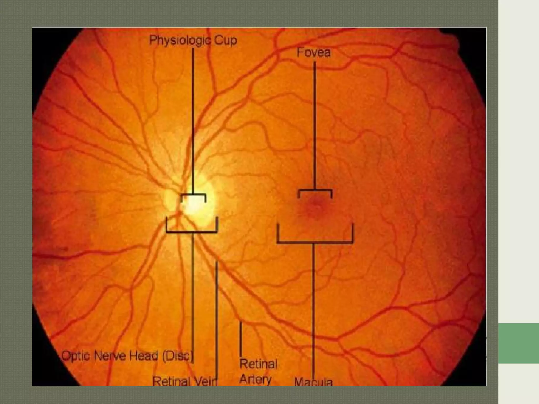 Anatomy of macula | PPTX | Eye and Vision Conditions | Diseases and ...