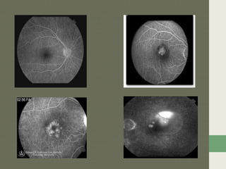 Anatomy of macula | PPTX
