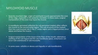 Anatomy of mandible | PPTX