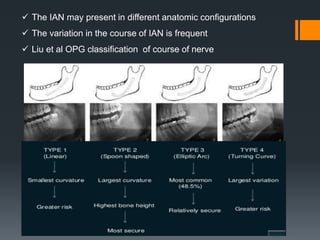 Anatomy of mandible and its importance in implant placement | PPTX