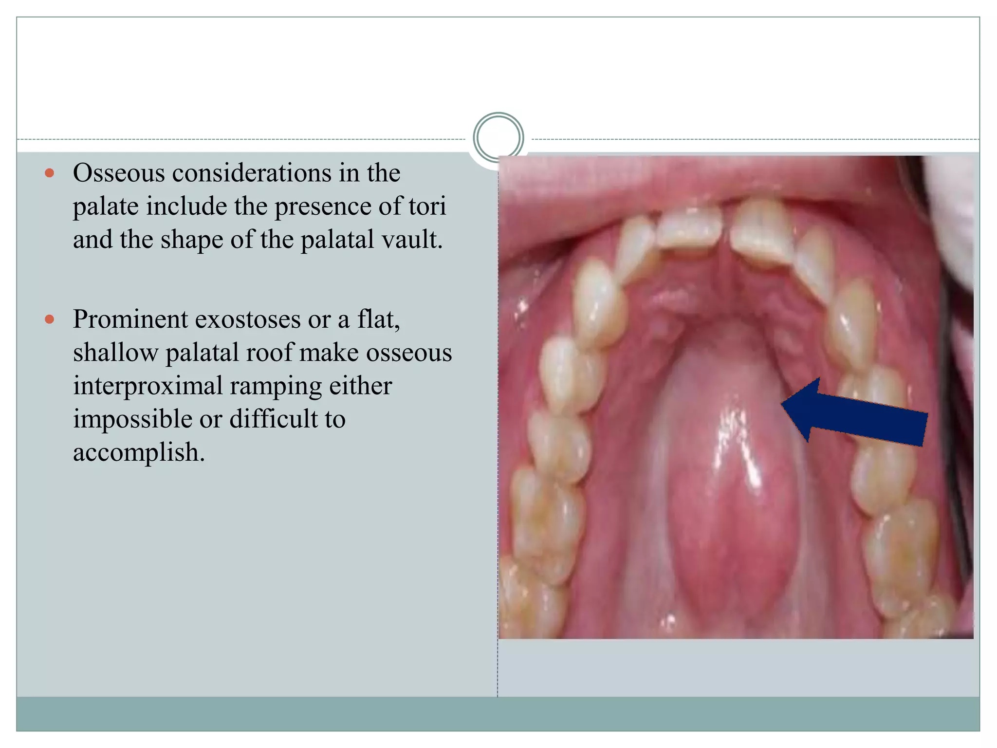 Anatomy of maxilla and its development | PPTX