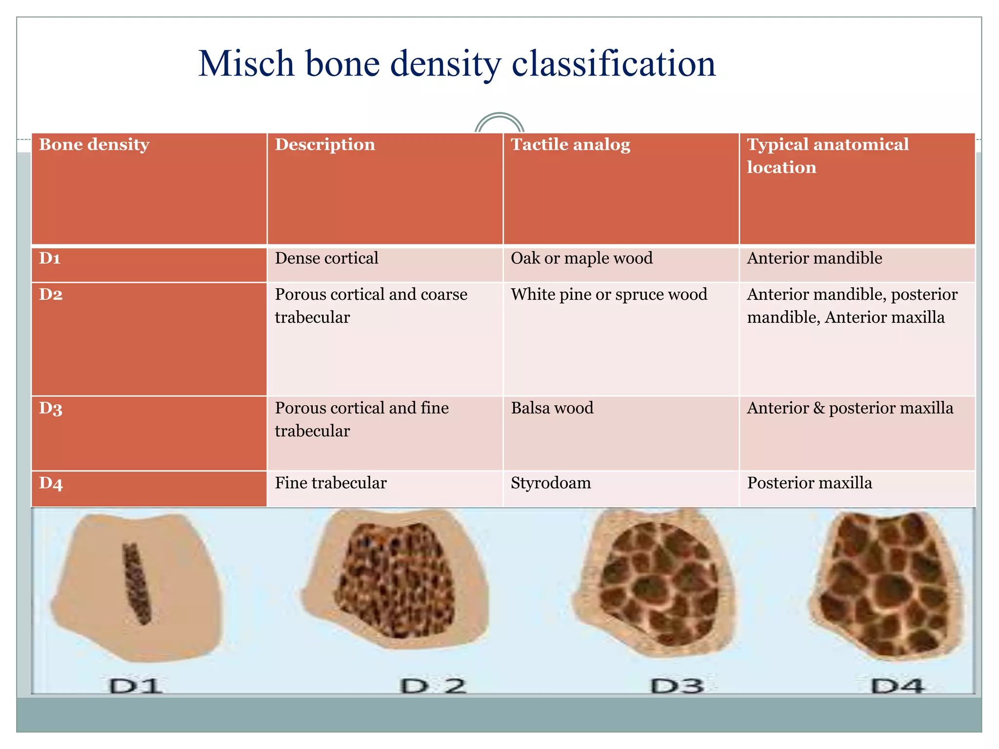 Anatomy of maxilla and its development | PPTX