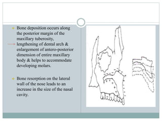 Maxillary Tuberosity Anatomy