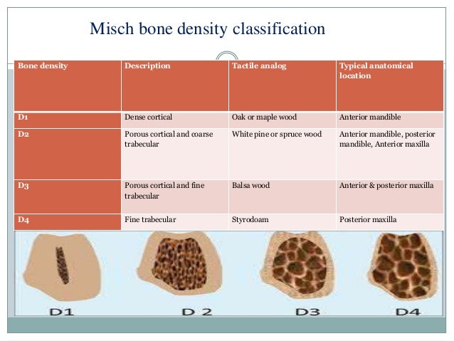 Anatomy of maxilla and its development