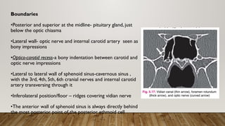 Anatomy of Maxillary, Frontal and Sphenoid sinuses.pptx