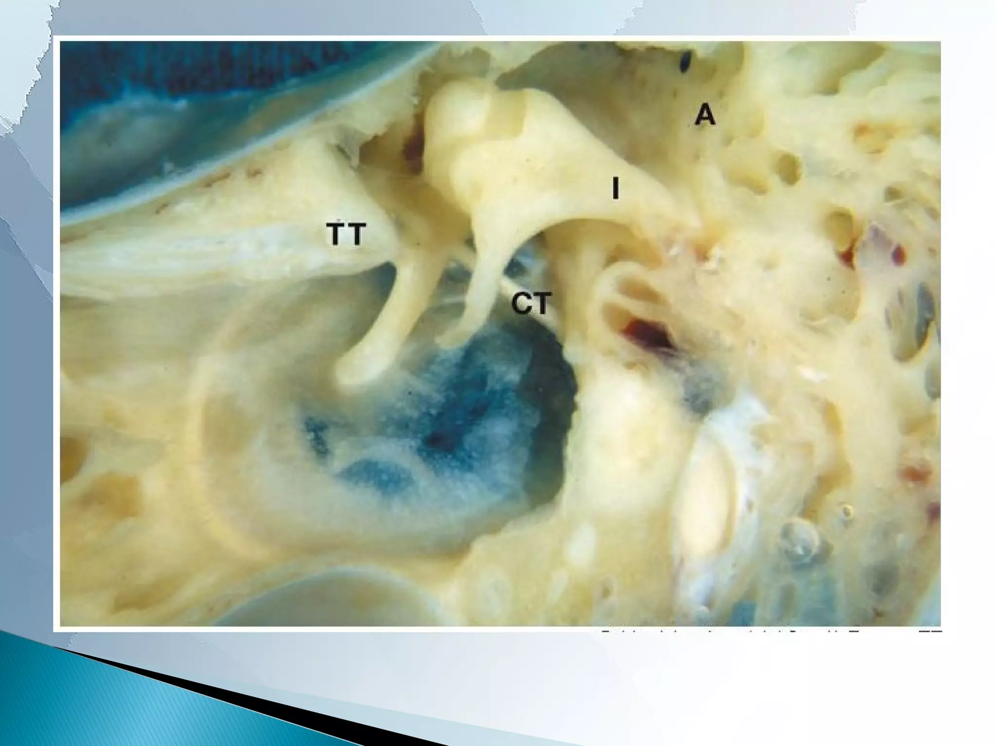 ANATOMY OF MIDDLE EAR CLEFT | PPT