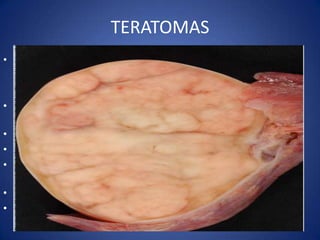 Anatomy of mediastinum and its disorders | PPTX