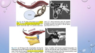 Anatomy of middle ear | PPTX