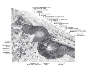 Anatomy of middle ear | PPTX