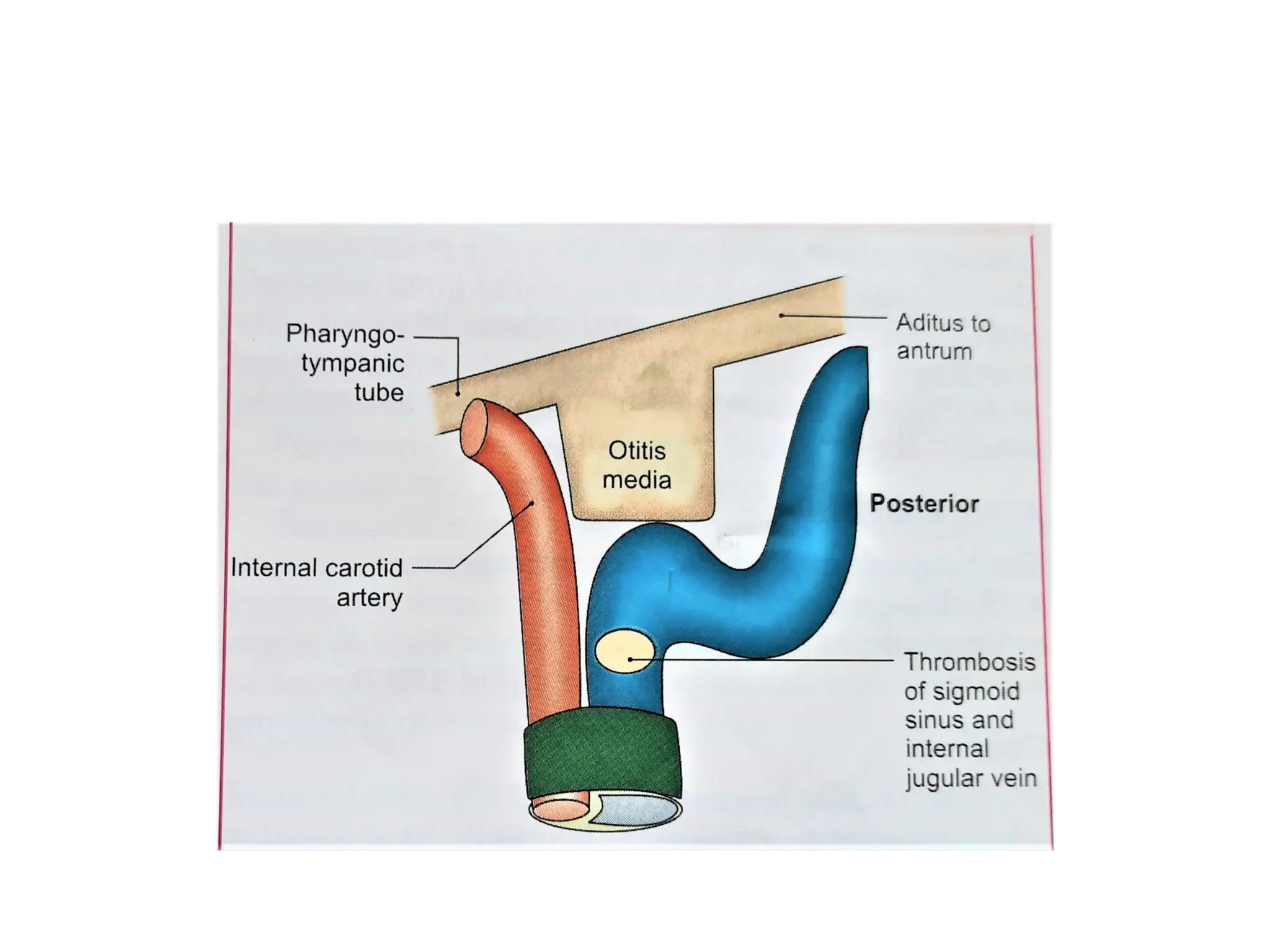 The Gross Anatomy of external and Middle ear Middle Ear | PPTX | Ear ...