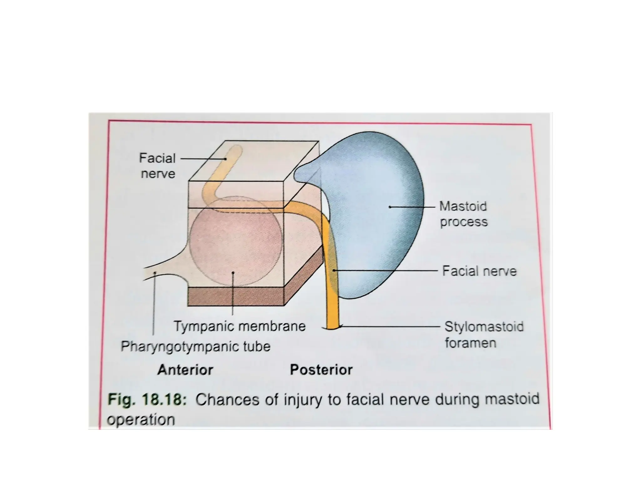 The Gross Anatomy of external and Middle ear Middle Ear | PPTX | Ear ...