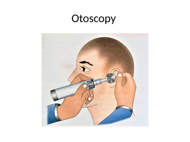 The Gross Anatomy of external and Middle ear Middle Ear | PPTX | Ear ...