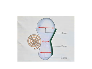 The Gross Anatomy of external and Middle ear Middle Ear | PPTX | Ear ...