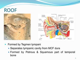 Anatomy of middle ear and its radiological correlation | PPTX