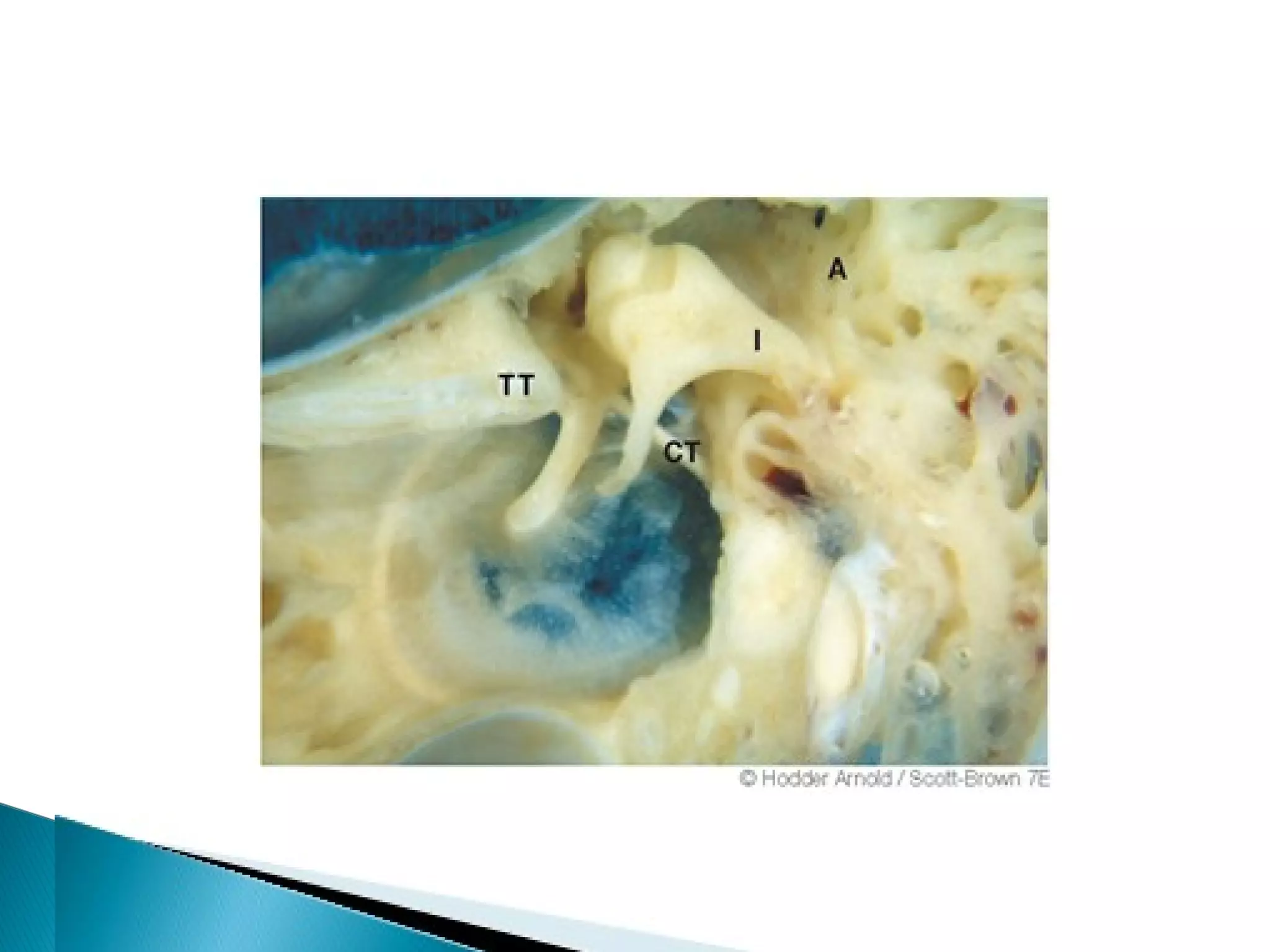 Anatomy of middle ear cleft microteaching, 06.03.17, dr.pk