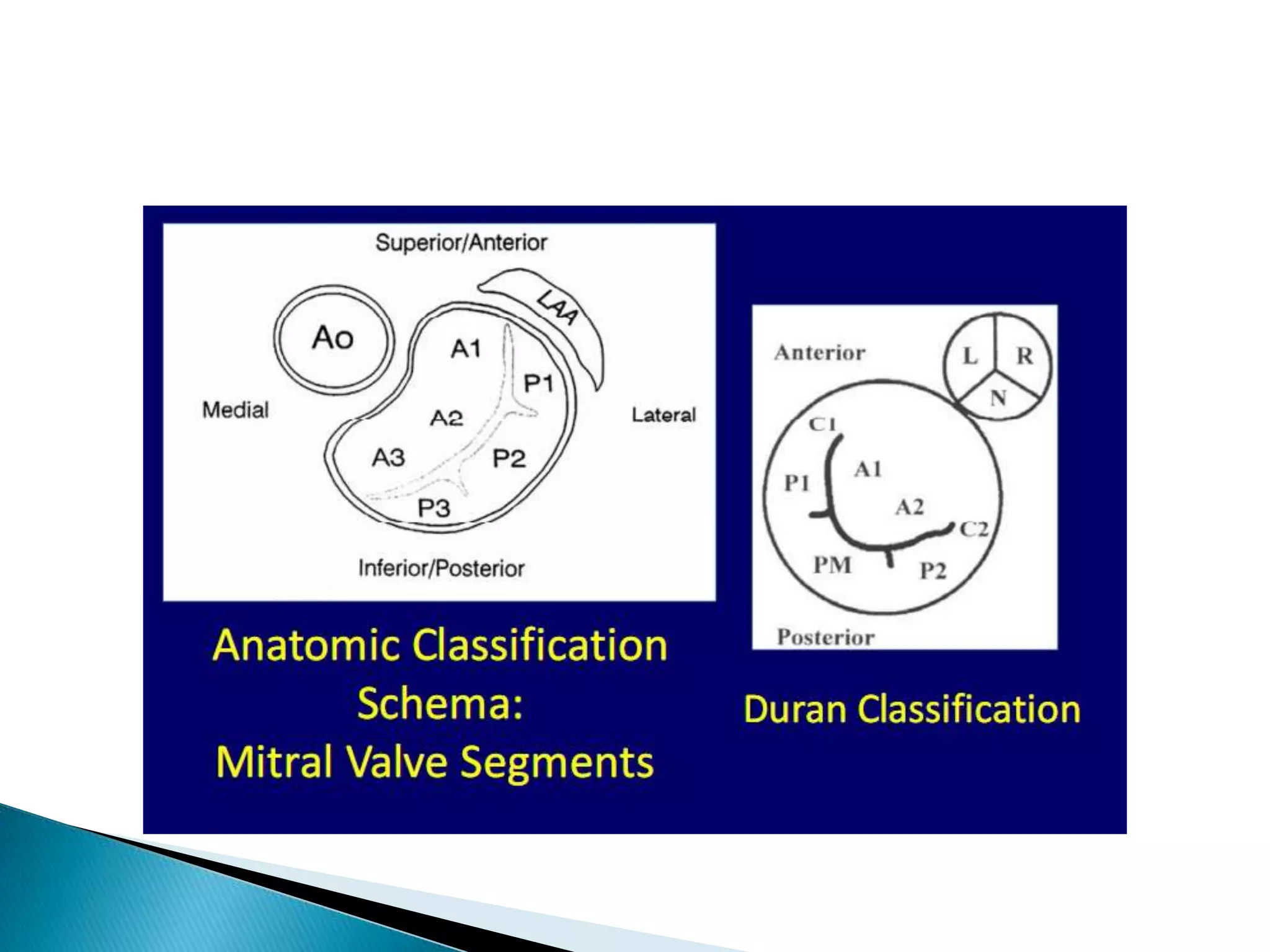 Anatomy of mitral valve echo evaluation | PPTX