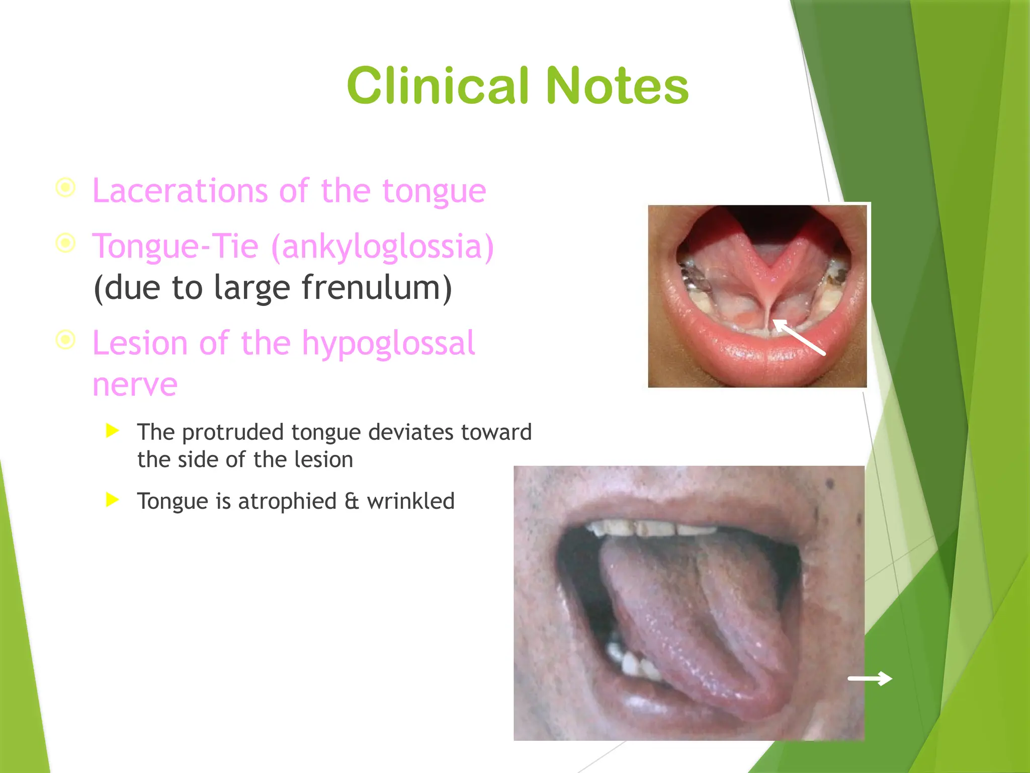 Anatomy of human mouth clearly described.pptx