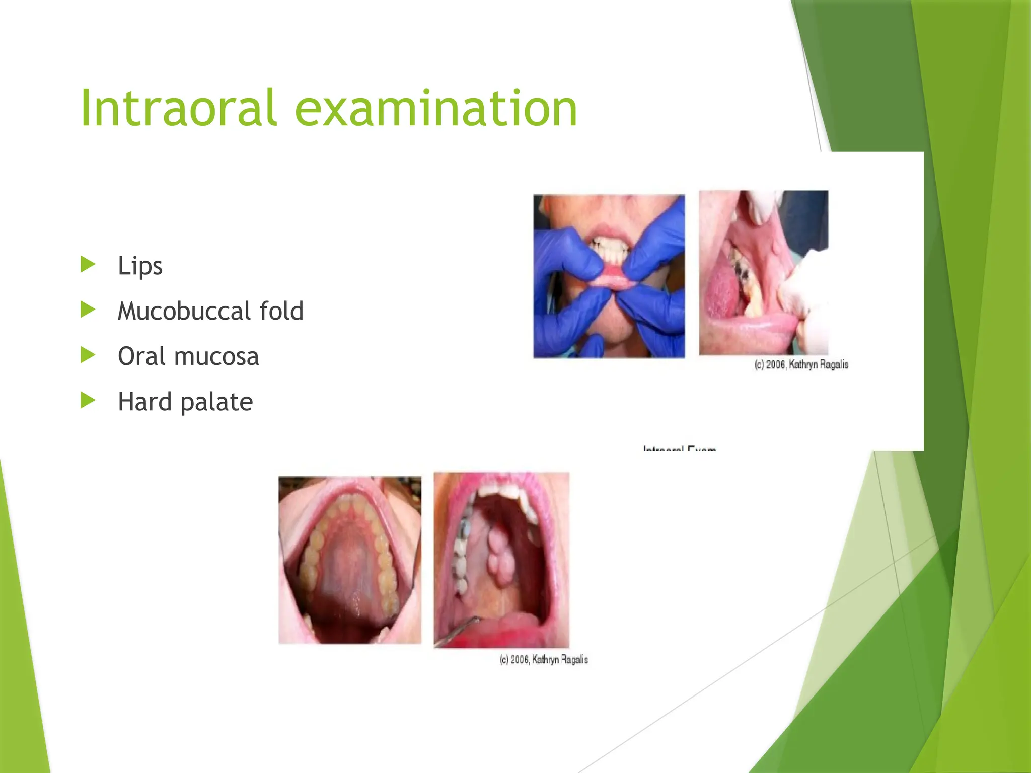Anatomy of human mouth clearly described.pptx