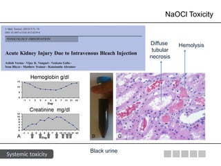 Anatomy of NaOCl accidents involving facial ecchymosis.pptx