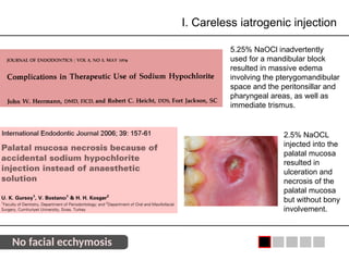 Anatomy of NaOCl accidents involving facial ecchymosis.pptx