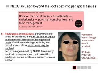 Anatomy of NaOCl accidents involving facial ecchymosis.pptx