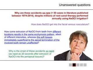 Anatomy of NaOCl accidents involving facial ecchymosis.pptx