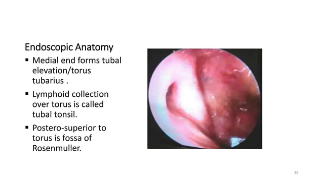 Anatomy of Nasopharynx and Eustachian Tube.pptx | Ear, Nose and Throat ...