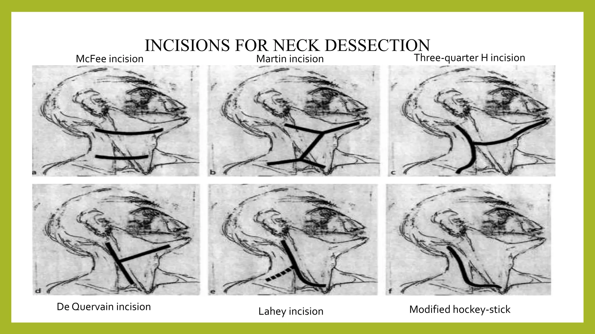 ANATOMY OF NECK.pptx