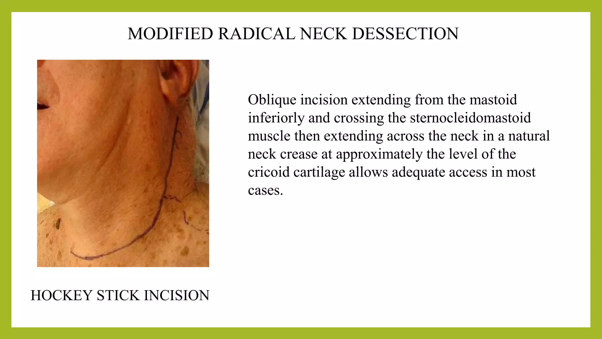 ANATOMY OF NECK.pptx