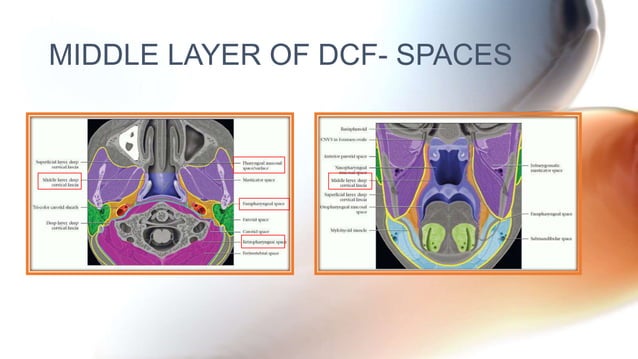 Anatomy of deep neck spaces | PPTX | Death, Injury, or Military ...