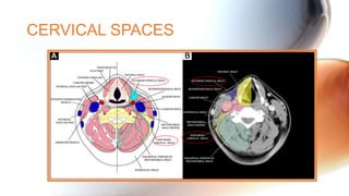 Anatomy of deep neck spaces | PPTX