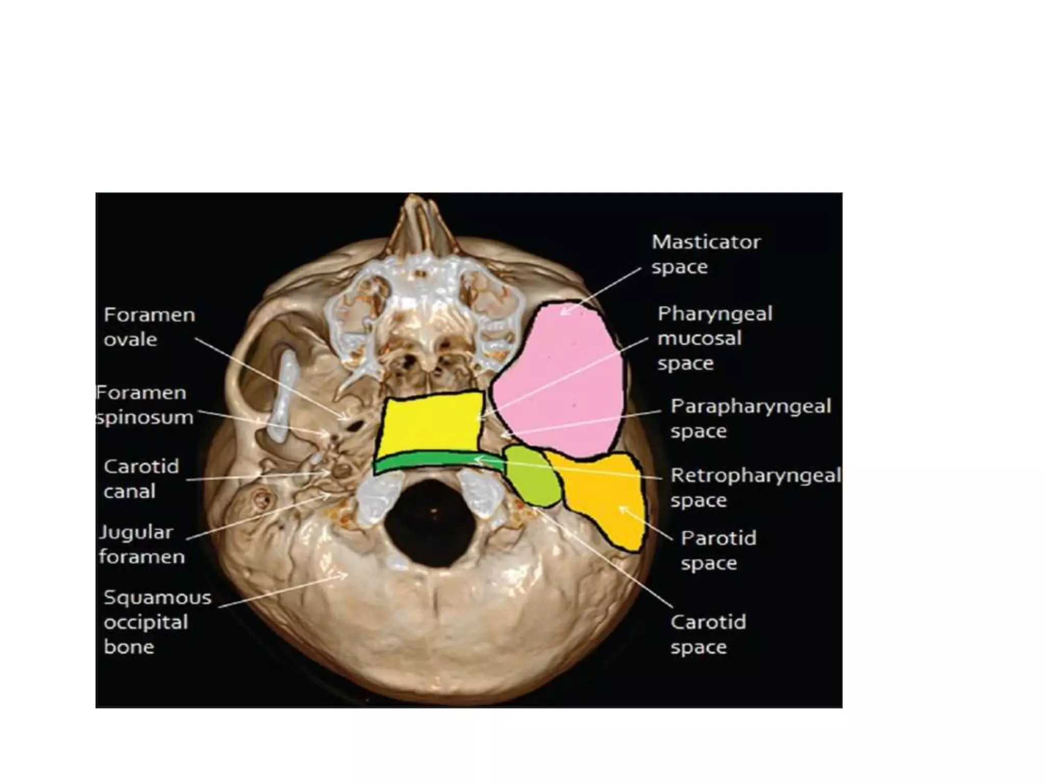 Radiological approach to neck spaces | PPTX