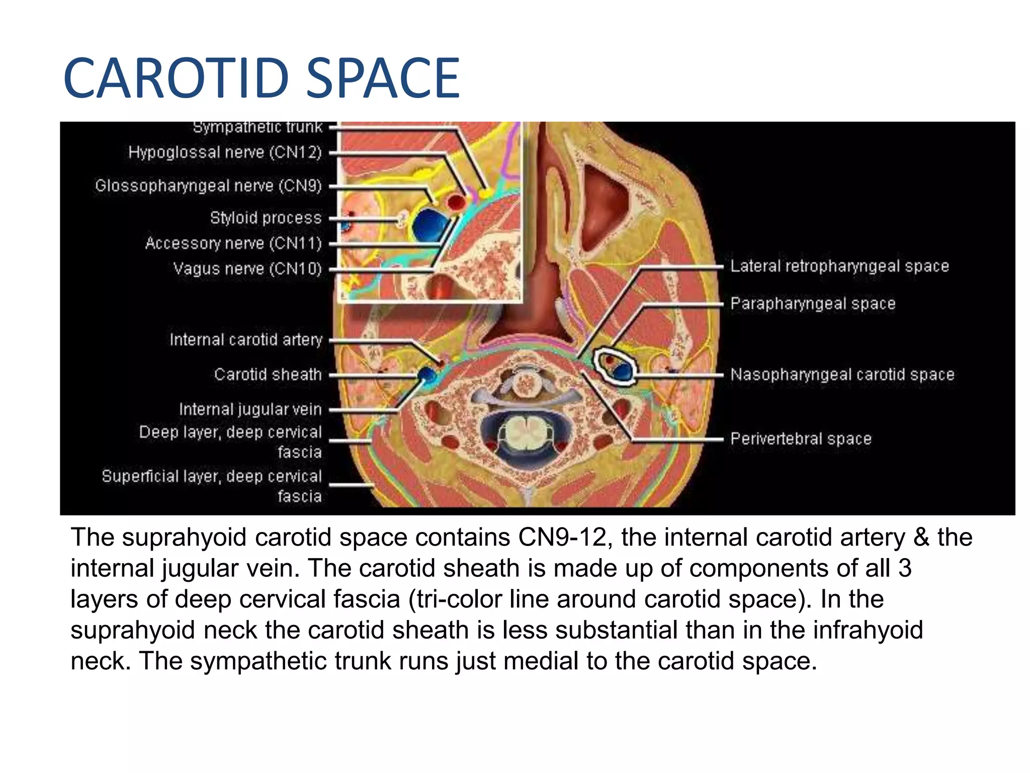 Radiological approach to neck spaces | PPTX