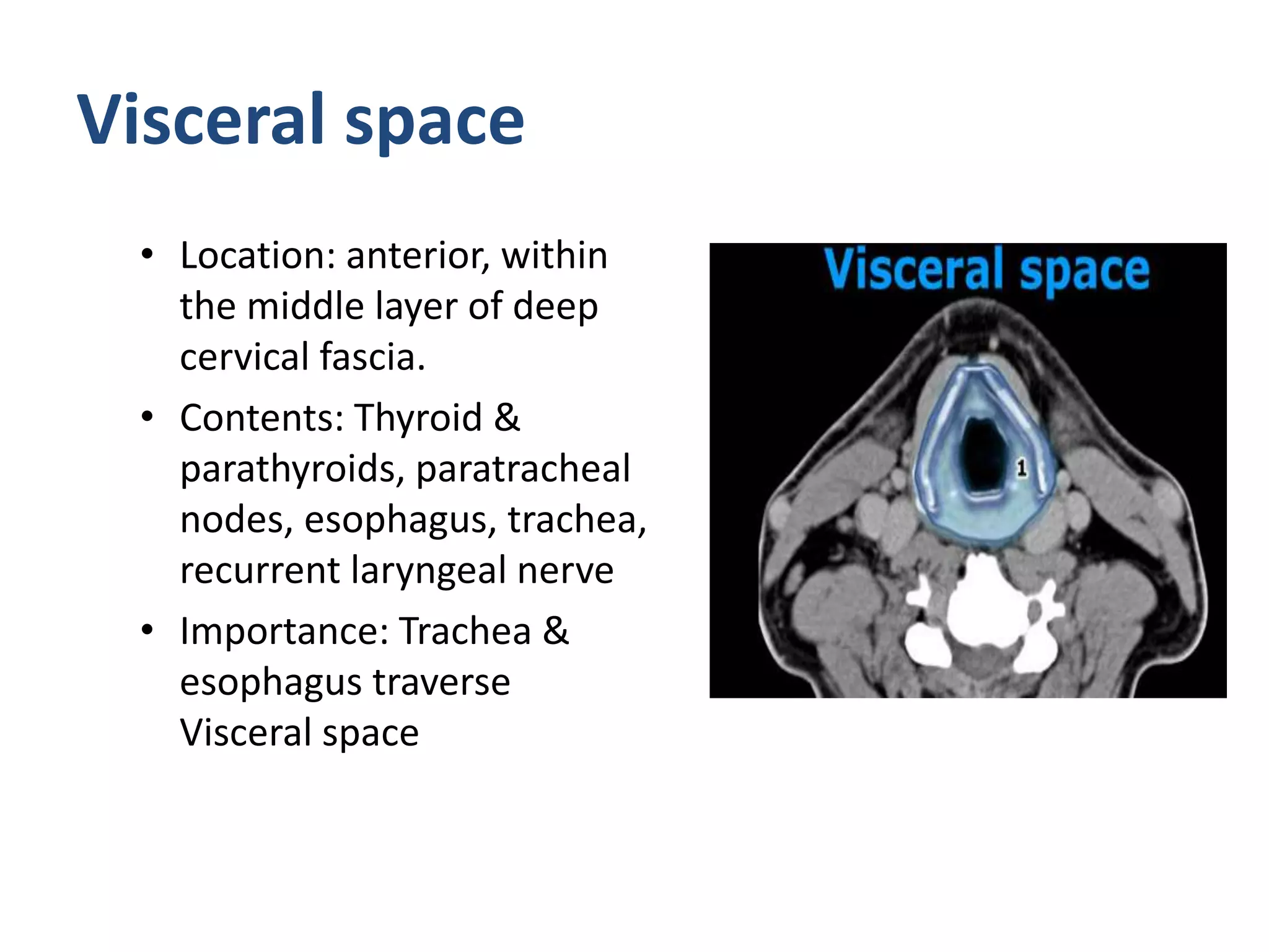 Radiological approach to neck spaces | PPTX